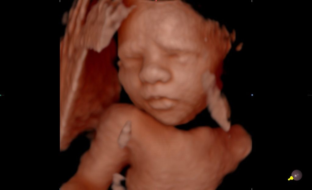 Minneapolis Little Bellies Ultrasound 2D 3D 4D 5D HD Pregnancy Spa Minneapolis Little Bellies Ultrasound 2D 3D 4D 5D HD Pregnancy Spa