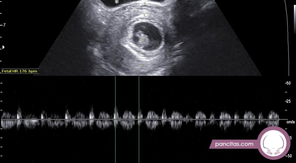 Austin Little Bellies Ultrasound 2D 3D 4D 5D HD Pregnancy Spa Austin Little Bellies Ultrasound 2D 3D 4D 5D HD Pregnancy Spa
