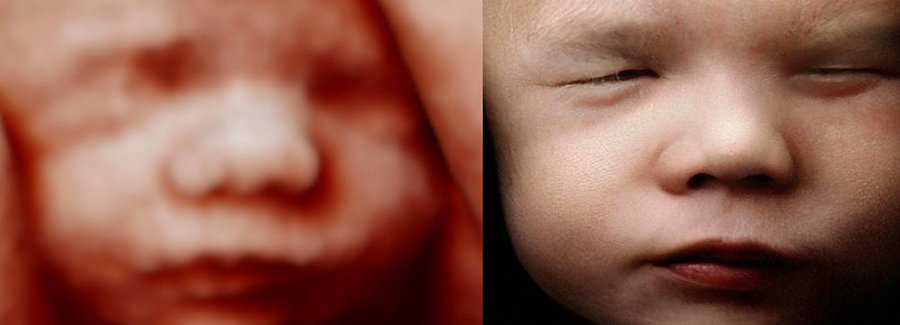 8K Realistic View Add-on - Little Bellies Ultrasound 2D/3D/4D - 5D/HD ...