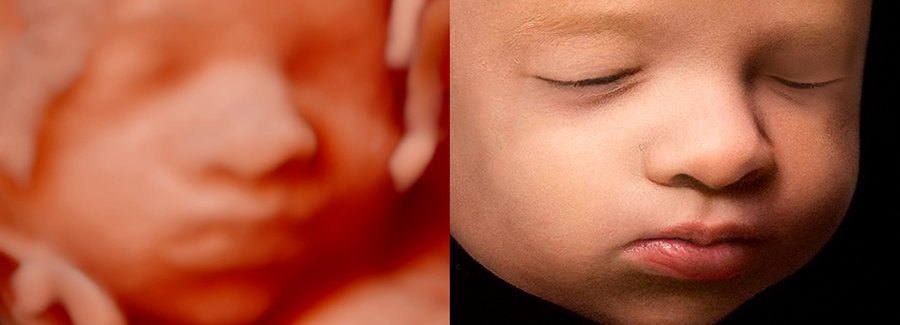 8K Realistic View Add-on - Little Bellies Ultrasound 2D/3D/4D - 5D/HD ...