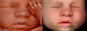 8K Realistic View Add-on - Little Bellies Ultrasound 2D/3D/4D - 5D/HD ...