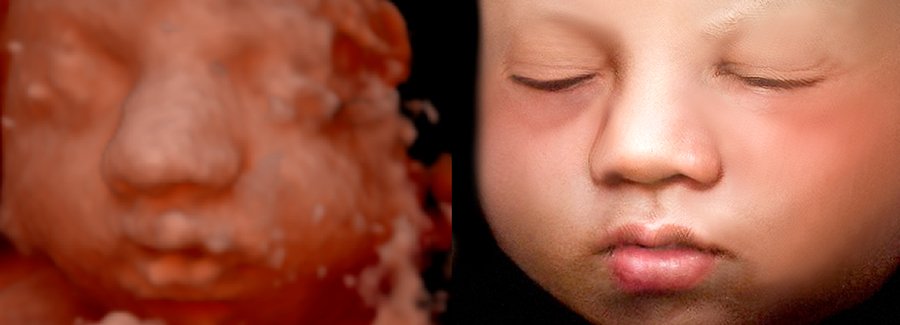 8K Realistic View Add-on - Little Bellies Ultrasound 2D/3D/4D - 5D/HD ...