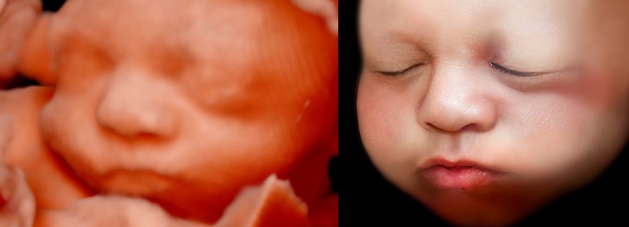 8K Realistic View Add-on - Little Bellies Ultrasound 2D/3D/4D - 5D/HD ...