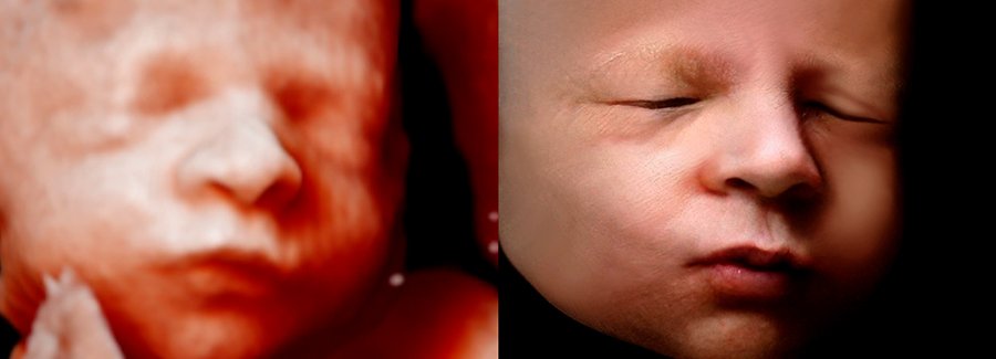 8K Realistic View Add-on - Little Bellies Ultrasound 2D/3D/4D - 5D/HD ...