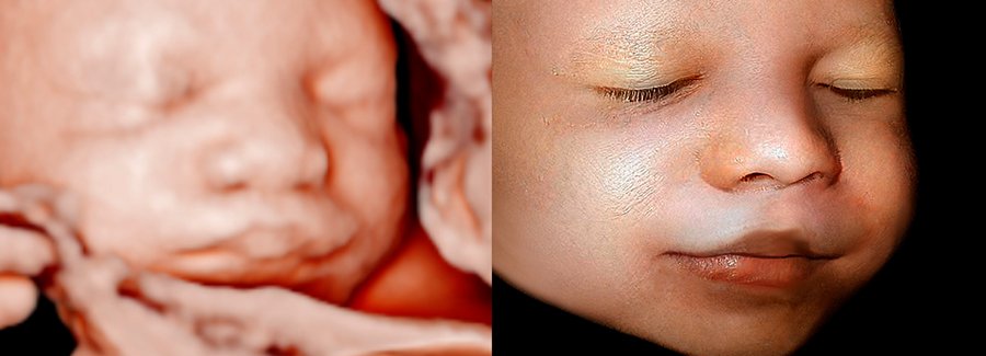 8K Realistic View Add-on - Little Bellies Ultrasound 2D/3D/4D - 5D/HD ...