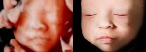 8K Realistic View Add-on - Little Bellies Ultrasound 2D/3D/4D - 5D/HD ...