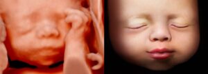 8K Realistic View Add-on - Little Bellies Ultrasound 2D/3D/4D - 5D/HD ...